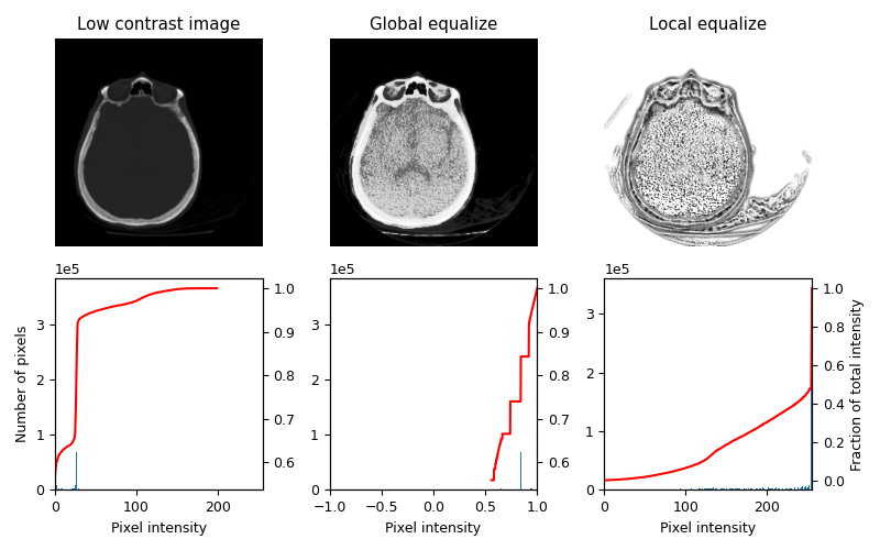 Local Histogram Equalization Skimage V0 20 0 Docs